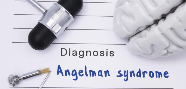 Angelman Syndrome: Symptoms, Causes, Treatment, & More - Care Options ...
