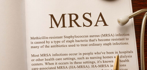MRSA in the Elderly: Symptoms, Diagnosis, Treatment & More