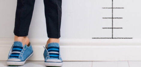 Russell Silver Syndrome: Causes, Symptoms, Treatment, & More - Care ...